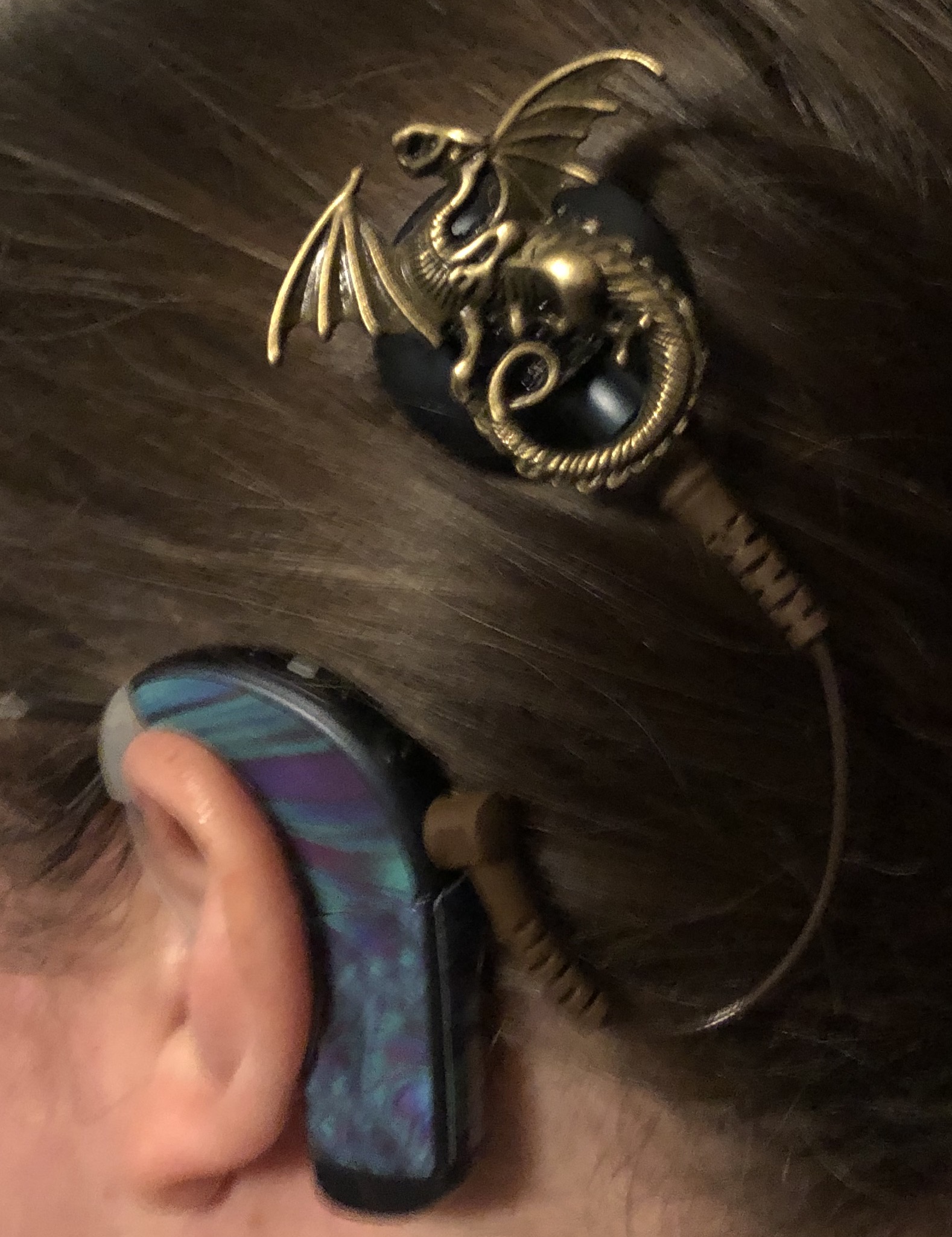 Decorations – A Cochlear Implant Journey